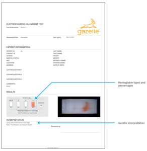Gazelle™ Hb Variant Test - CureLeads